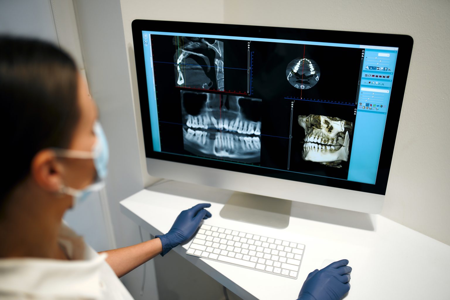 Ortopan – 1A medicina